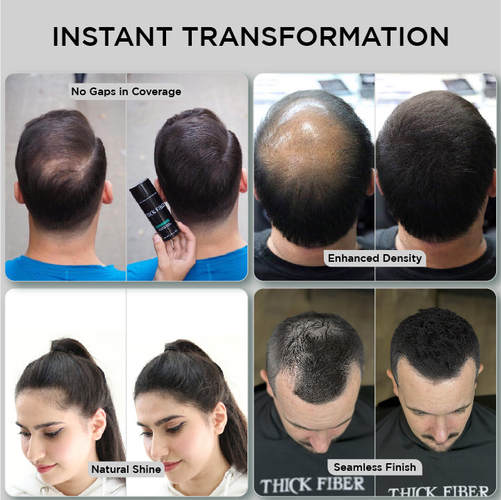 THICK FIBER Hair Building Fibers – Instant Hair Loss Concealer for ...